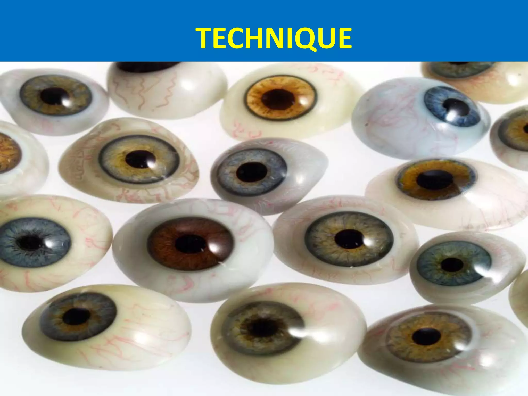 Ocular Prosthesis Fabrication | PPTX | Eye and Vision Conditions ...