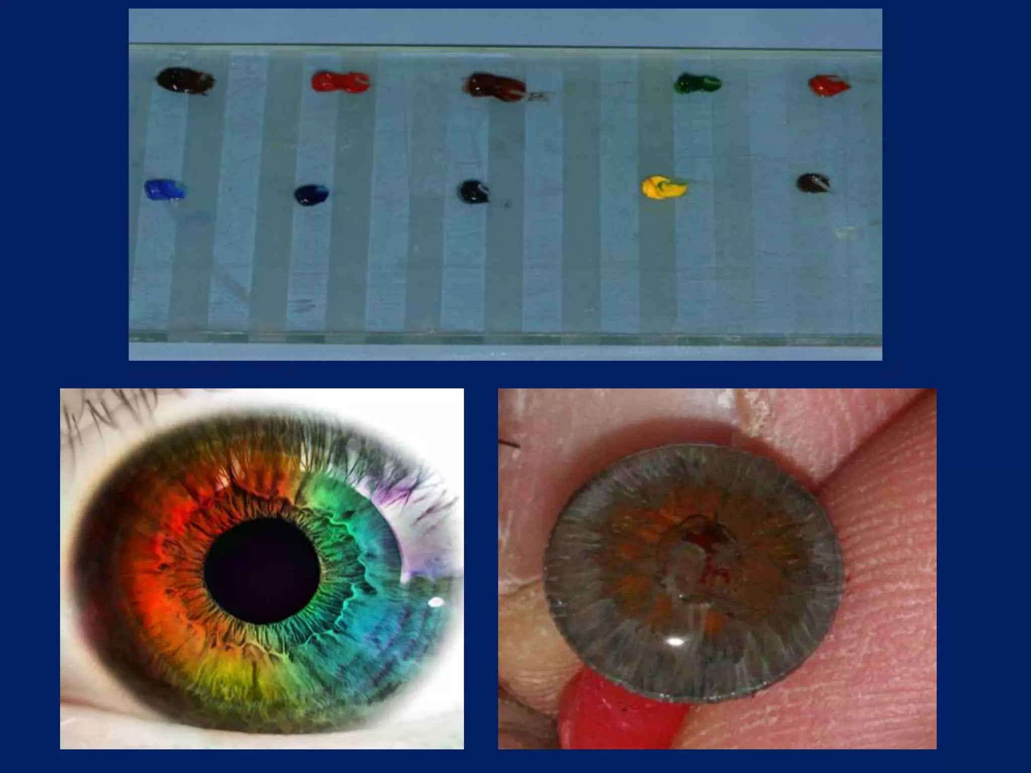 Ocular Prosthesis Fabrication | PPTX