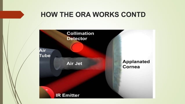 OCULAR RESPONSE ANALYZER ( ECHEOTU GLORY) copy.pptx