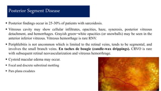 Ocular sarcoidosis | PPTX