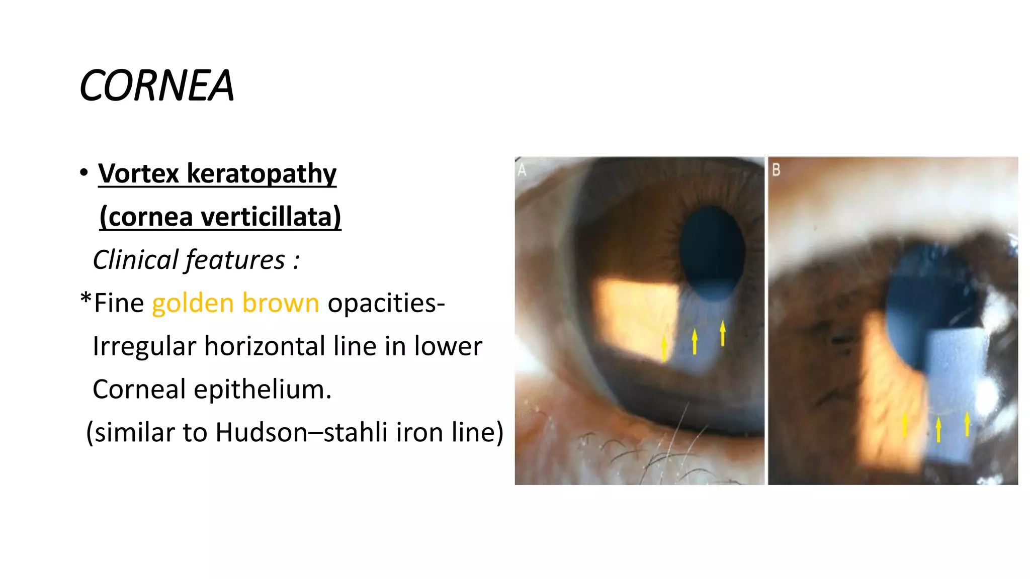 Ocular side effects of medicines | PPTX