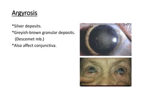 Ocular side effects of medicines | PPTX