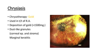 Ocular side effects of medicines | PPT