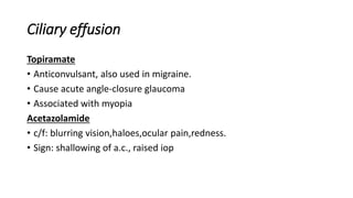 Ocular side effects of medicines | PPT
