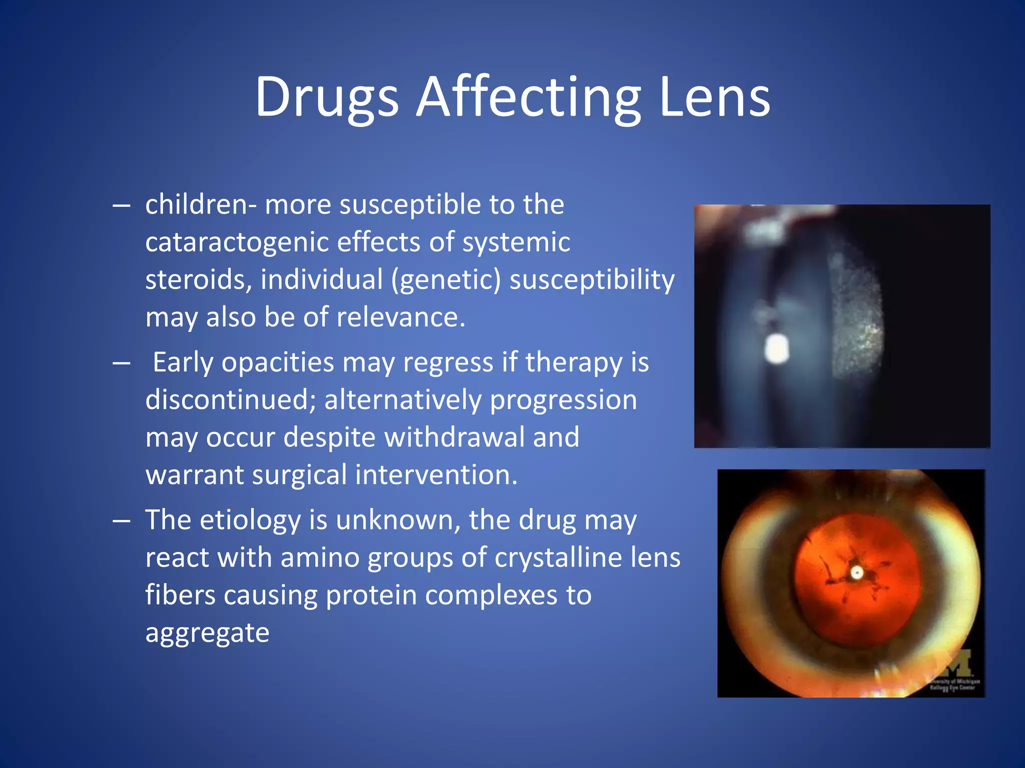Ocular side effects of systemic drugs | PPTX