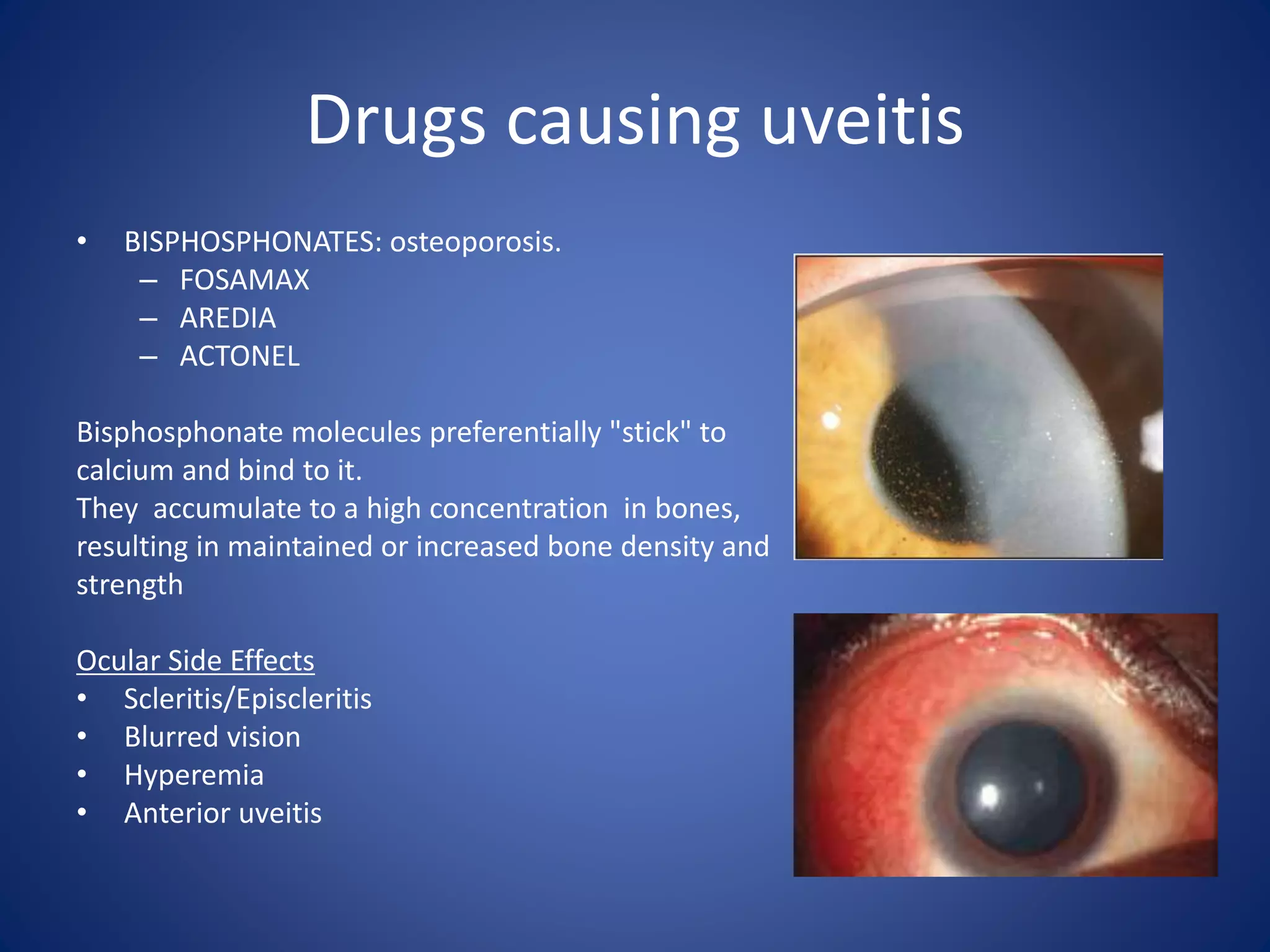 Ocular side effects of systemic drugs | PPTX