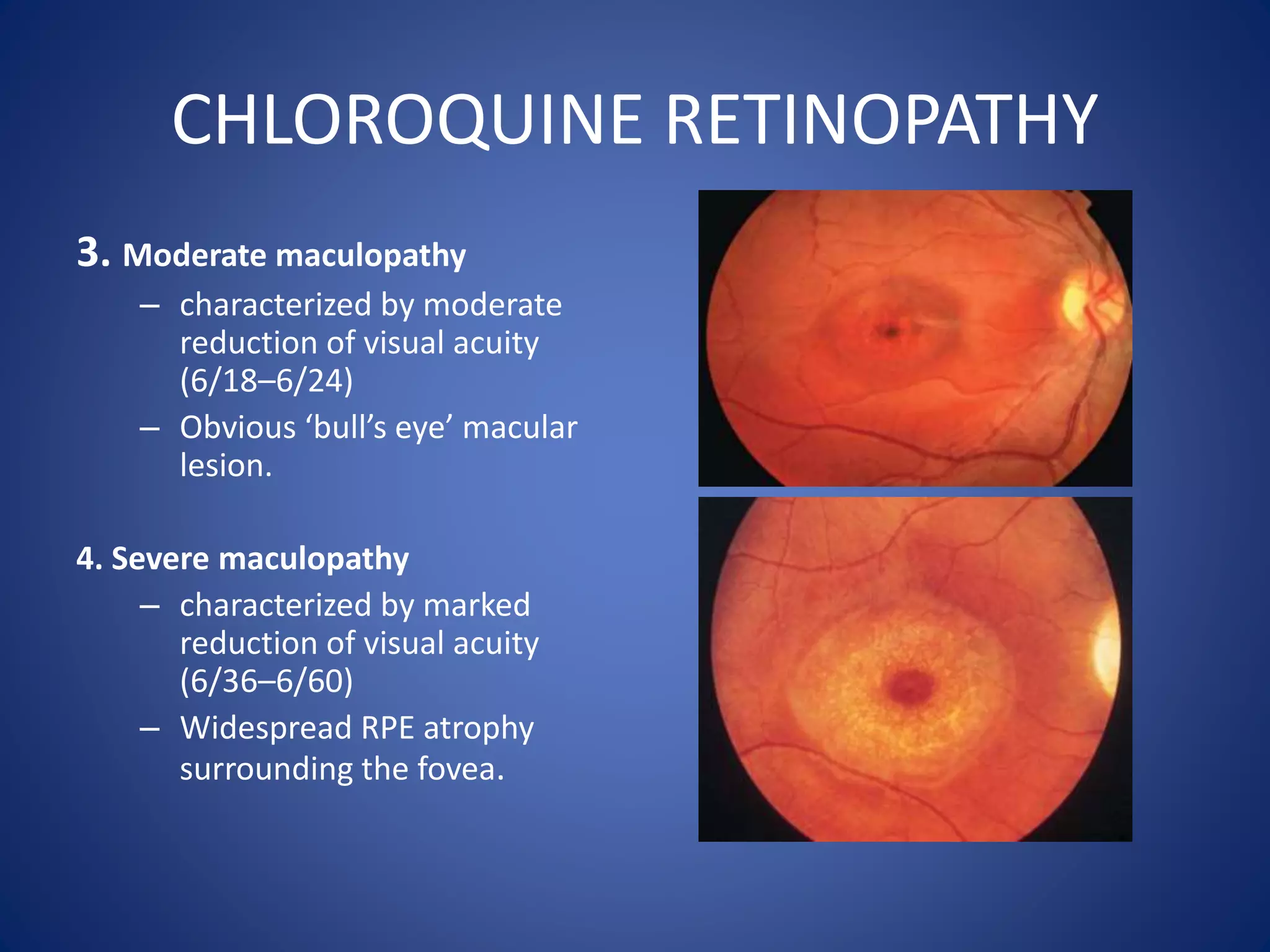 Ocular side effects of systemic drugs | PPTX