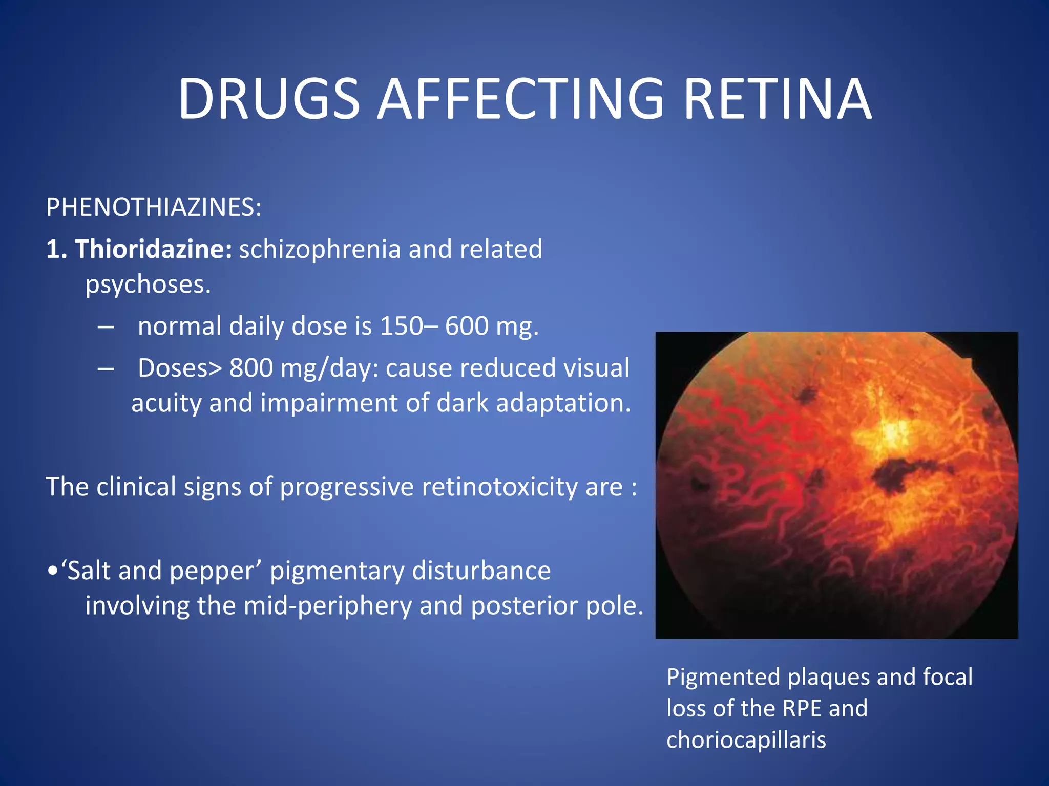 Ocular side effects of systemic drugs | PPTX