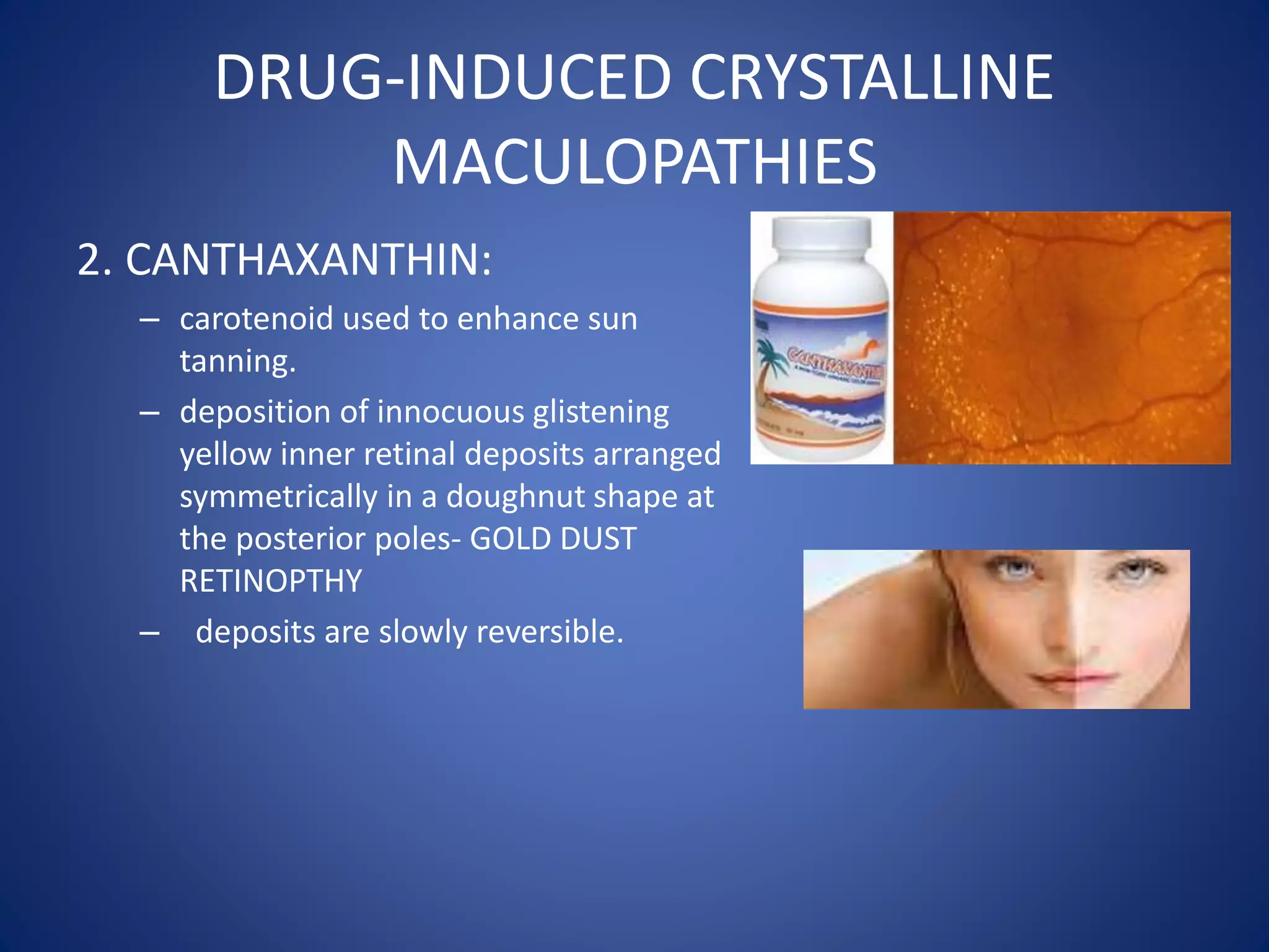 Ocular side effects of systemic drugs | PPTX