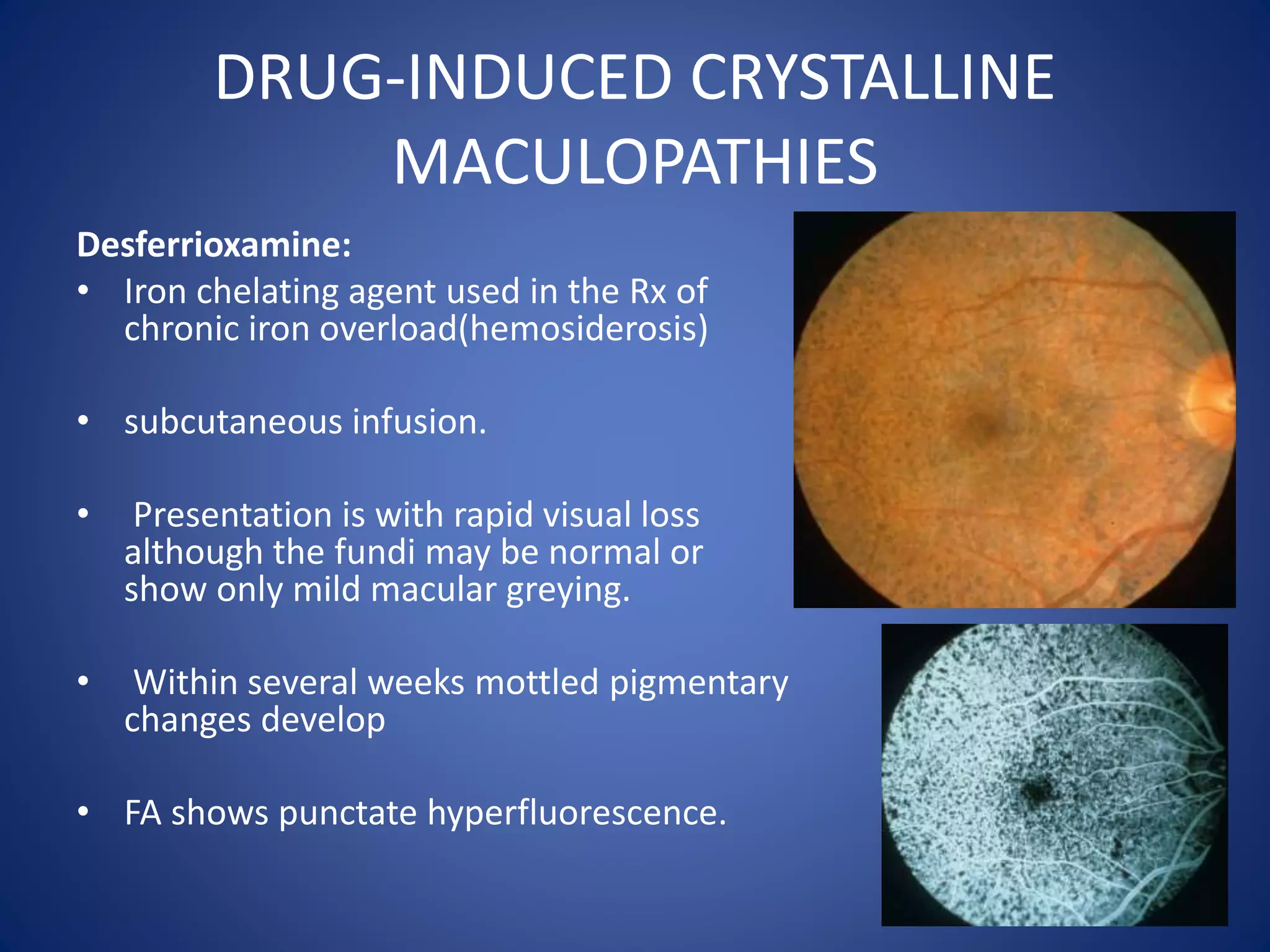 Ocular side effects of systemic drugs | PPTX