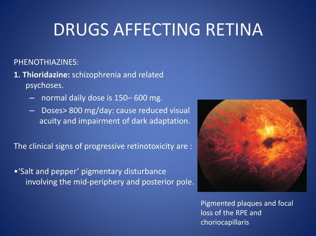 Ocular side effects of systemic drugs | PPTX | Eye and Vision ...