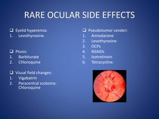 Ocular side effects of systemic drugs | PPTX