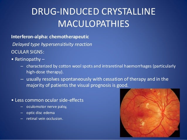 Ocular side effects of systemic drugs