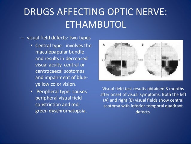 Ocular side effects of systemic drugs