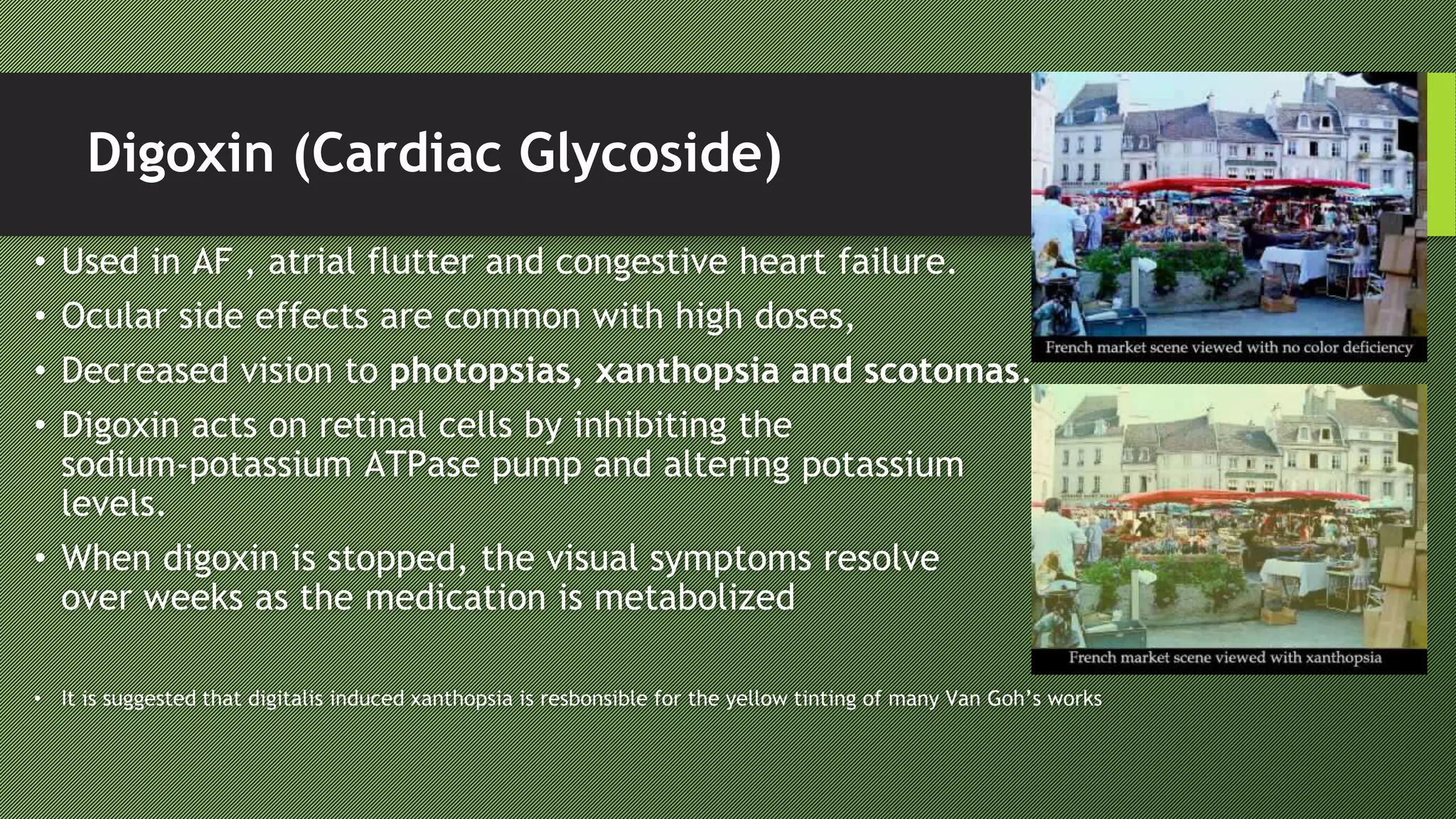 Ocular side effects of systemic drugs | PPTX