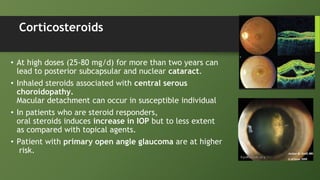 Ocular side effects of systemic drugs | PPTX
