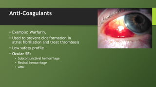Ocular side effects of systemic drugs | PPTX