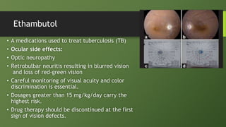 Ocular side effects of systemic drugs | PPTX