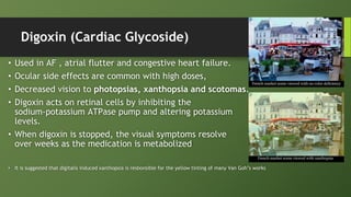 Ocular side effects of systemic drugs | PPTX