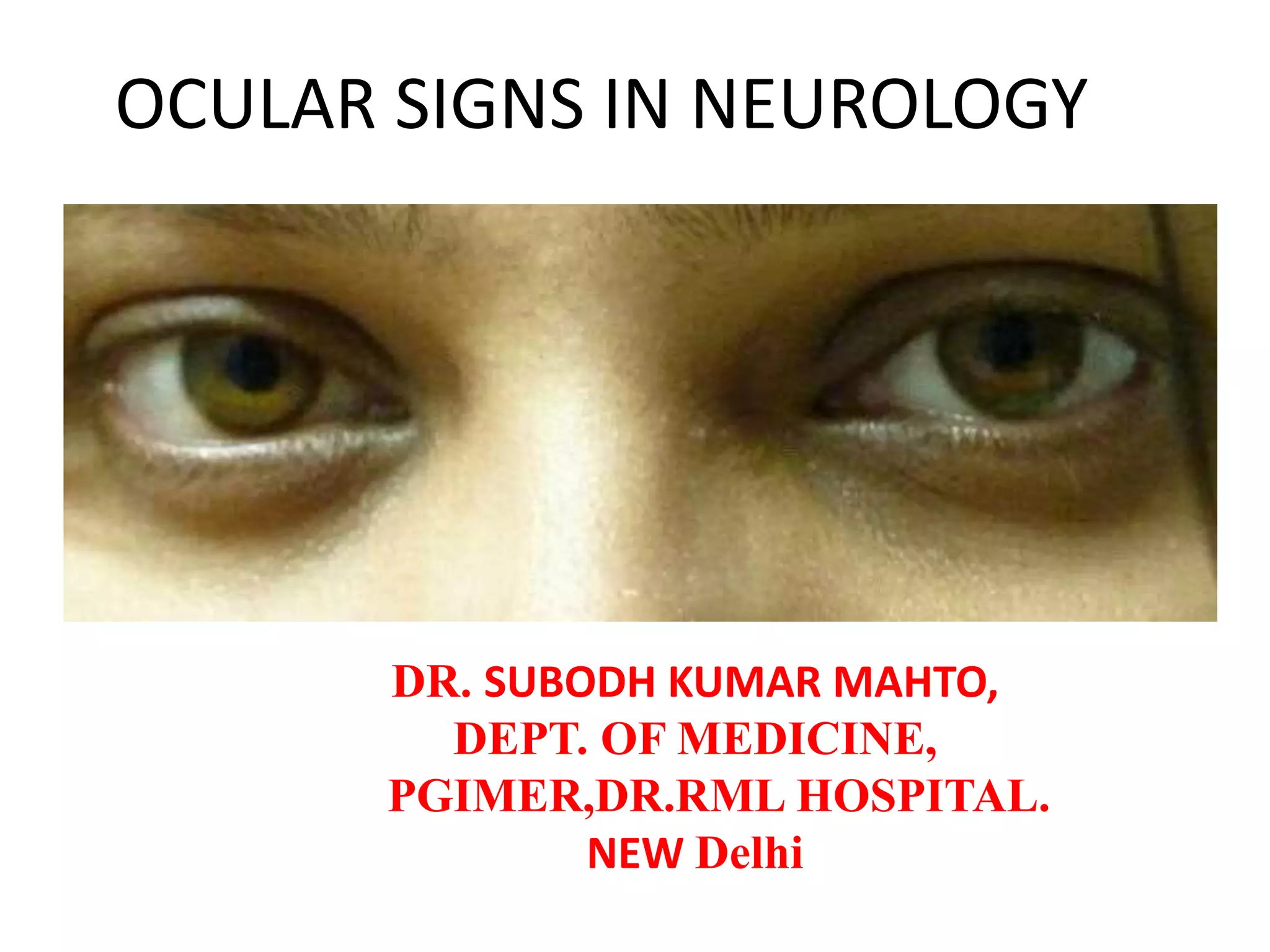Ocular signs in medicine/ neurology | PPTX
