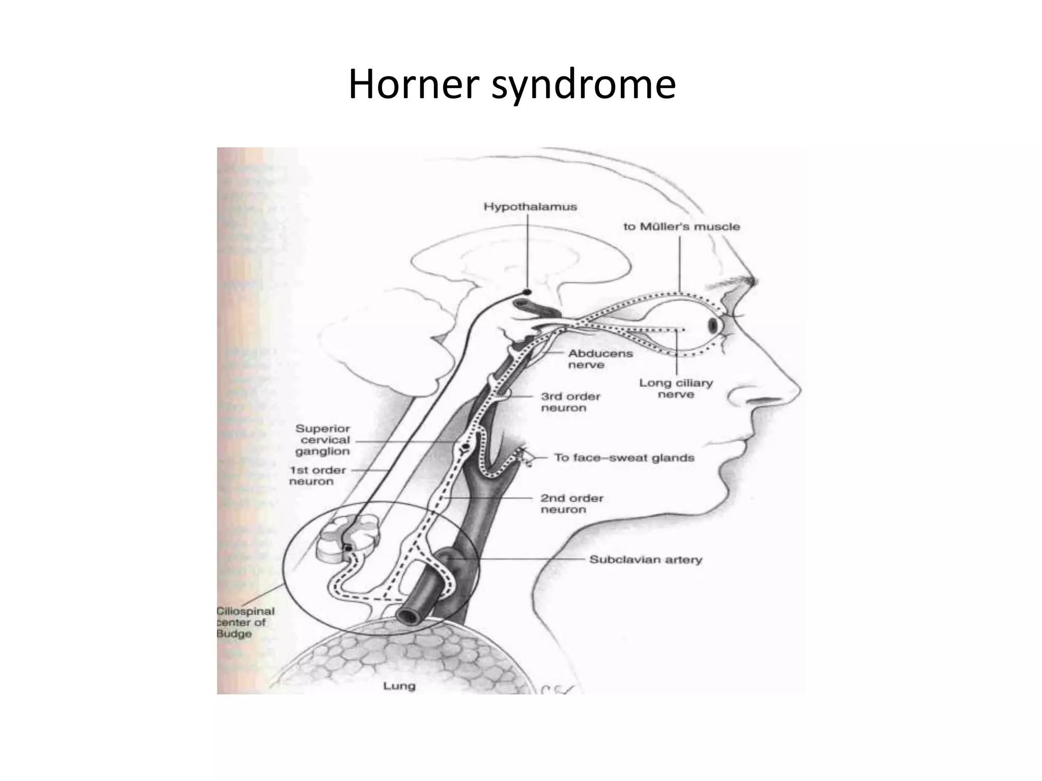 Ocular signs in medicine/ neurology | PPTX