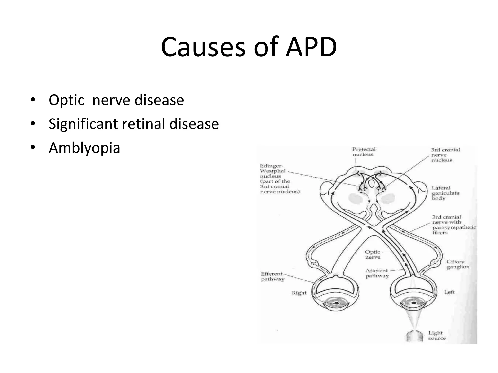 Ocular signs in medicine/ neurology | PPTX