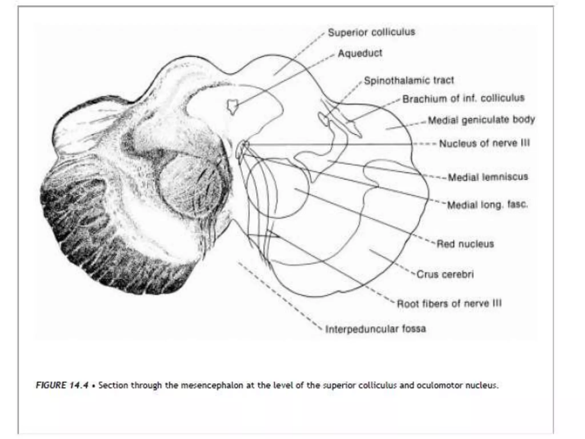 Ocular signs in medicine/ neurology | PPTX