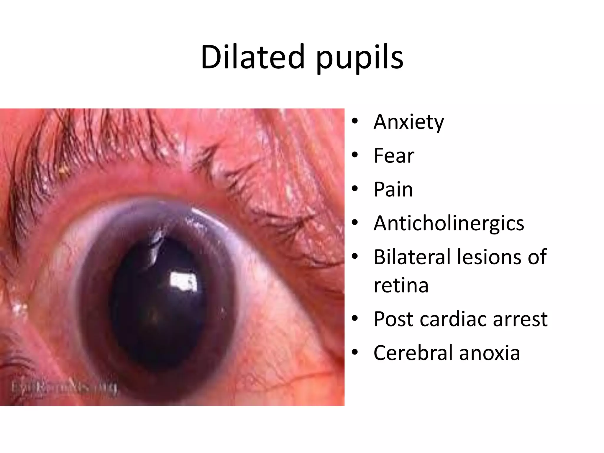 Ocular signs in medicine/ neurology | PPTX