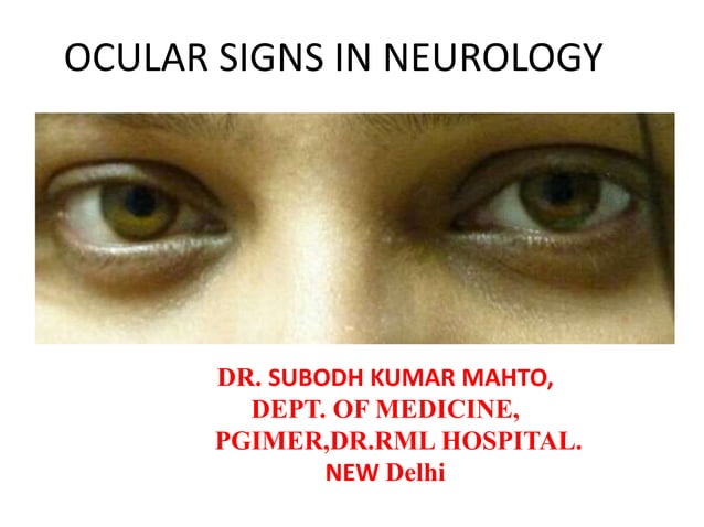 Ocular signs in medicine/ neurology | PPTX | Eye and Vision Conditions ...