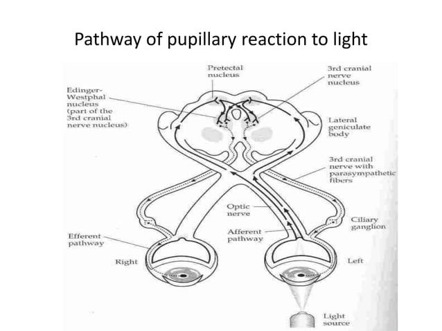 Ocular signs in medicine/ neurology | PPTX | Eye and Vision Conditions ...