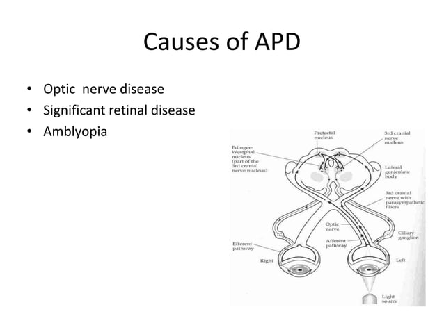 Ocular signs in medicine/ neurology | PPTX | Eye and Vision Conditions ...