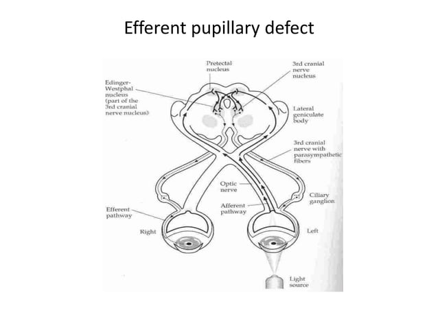Ocular signs in medicine/ neurology | PPTX | Eye and Vision Conditions ...