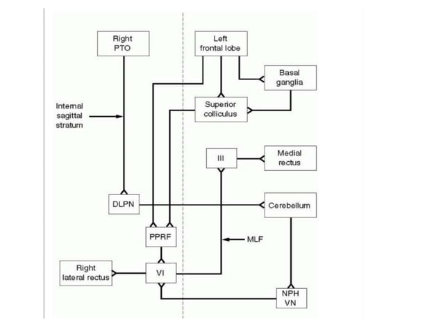 Ocular signs in medicine/ neurology | PPTX | Eye and Vision Conditions ...