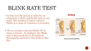 Dry Eye and Ocular surface diseases in diabetes mellitus | PPTX