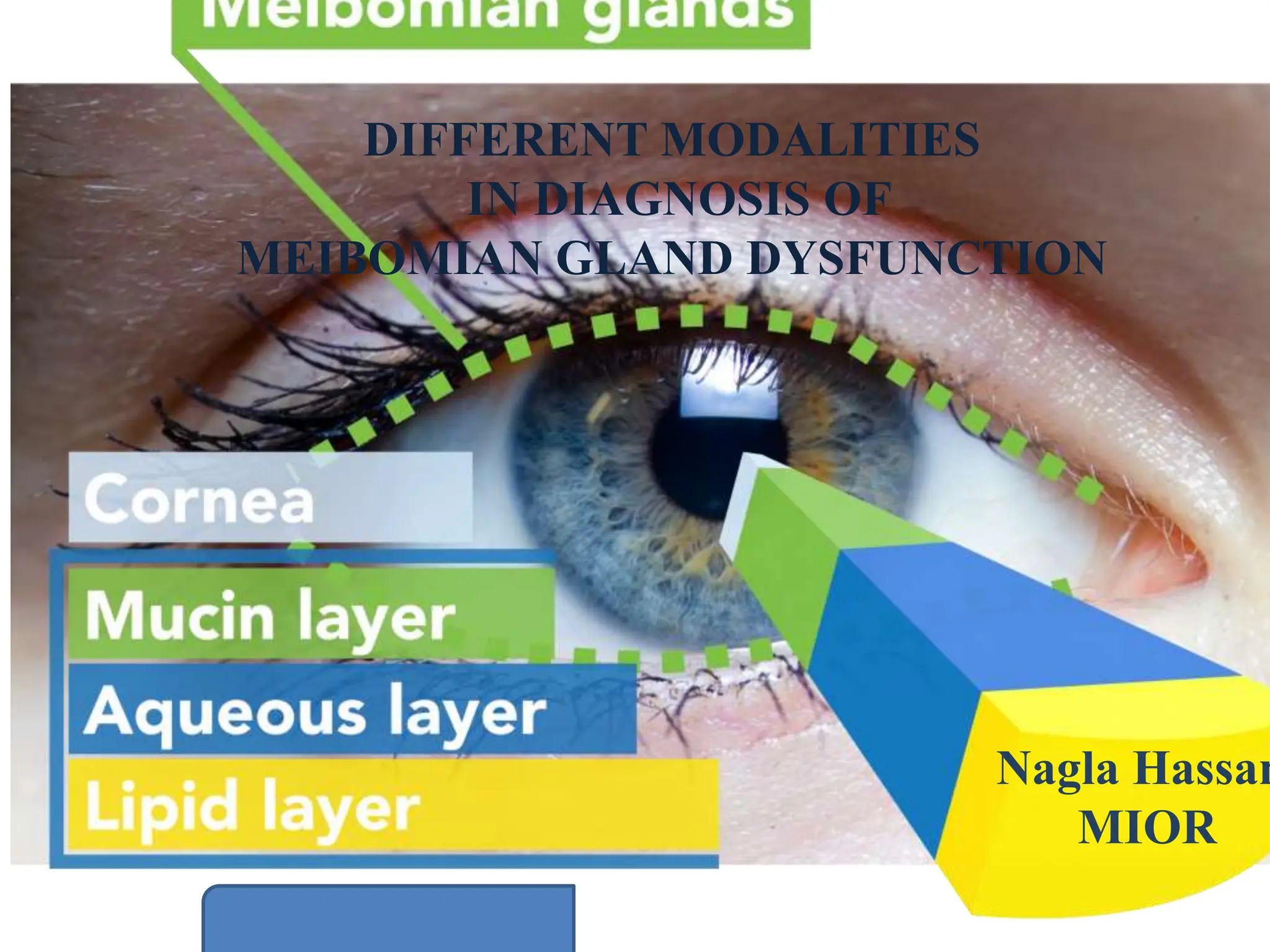 ocular surface lecture.pptx