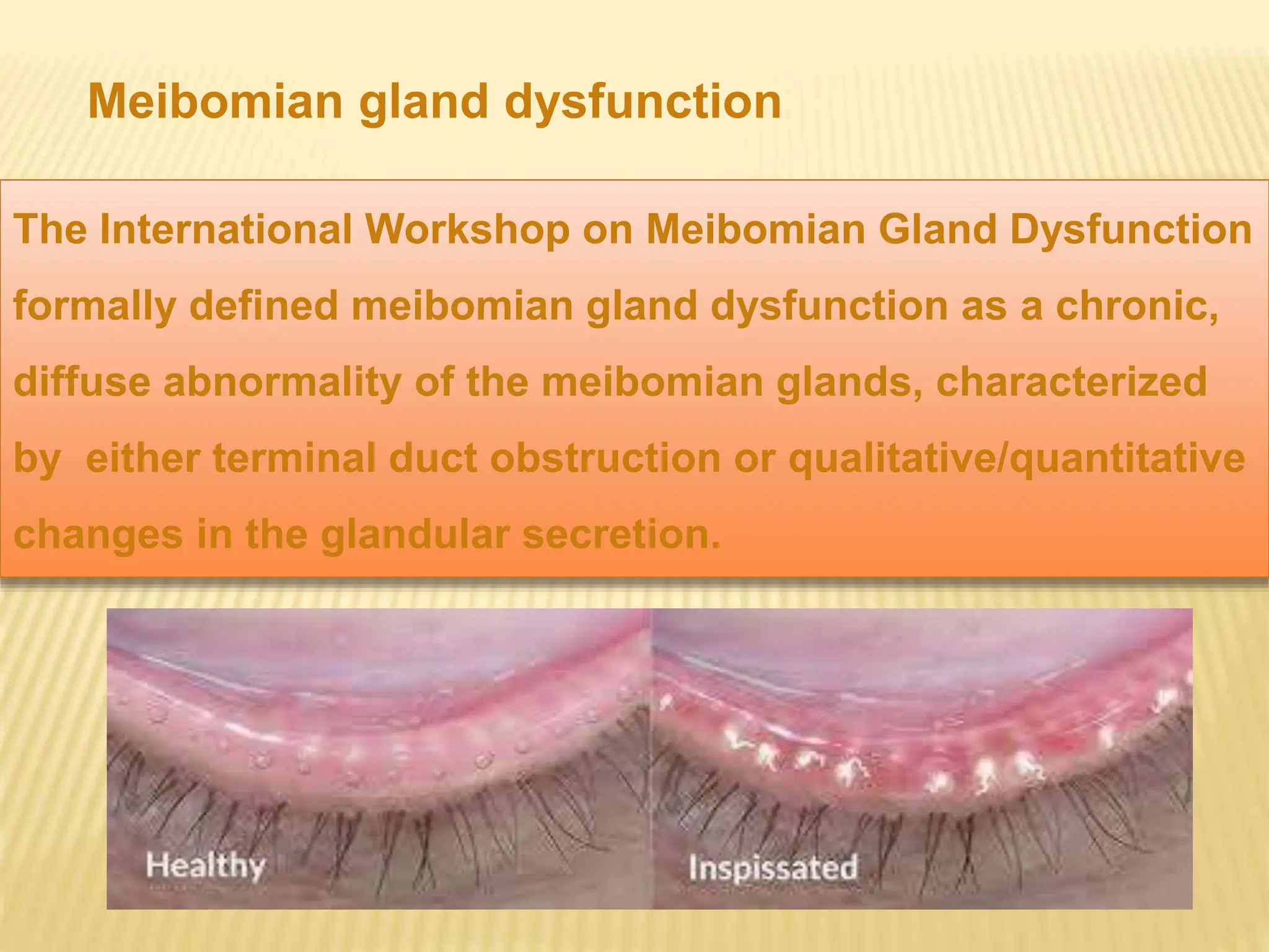 ocular surface lecture.pptx