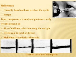 ocular surface lecture.pptx