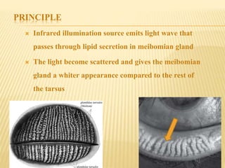 ocular surface lecture.pptx