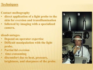 ocular surface lecture.pptx