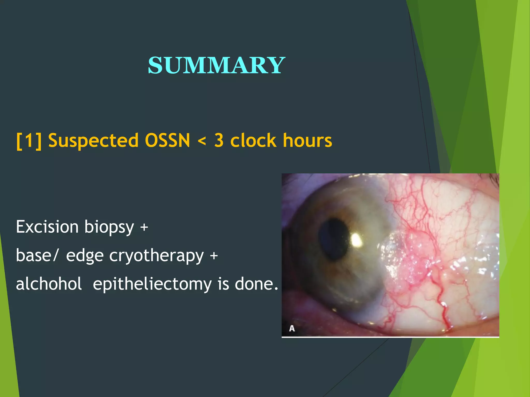 Ocular surface squamous neoplasia | PPT