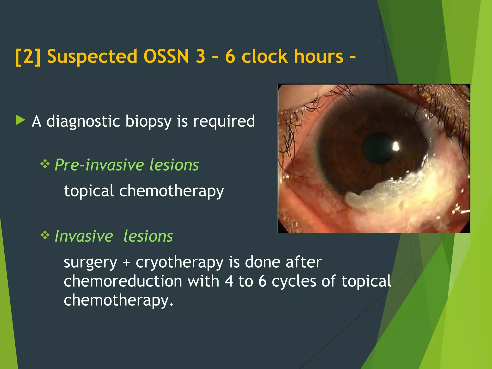Ocular surface squamous neoplasia | PPT