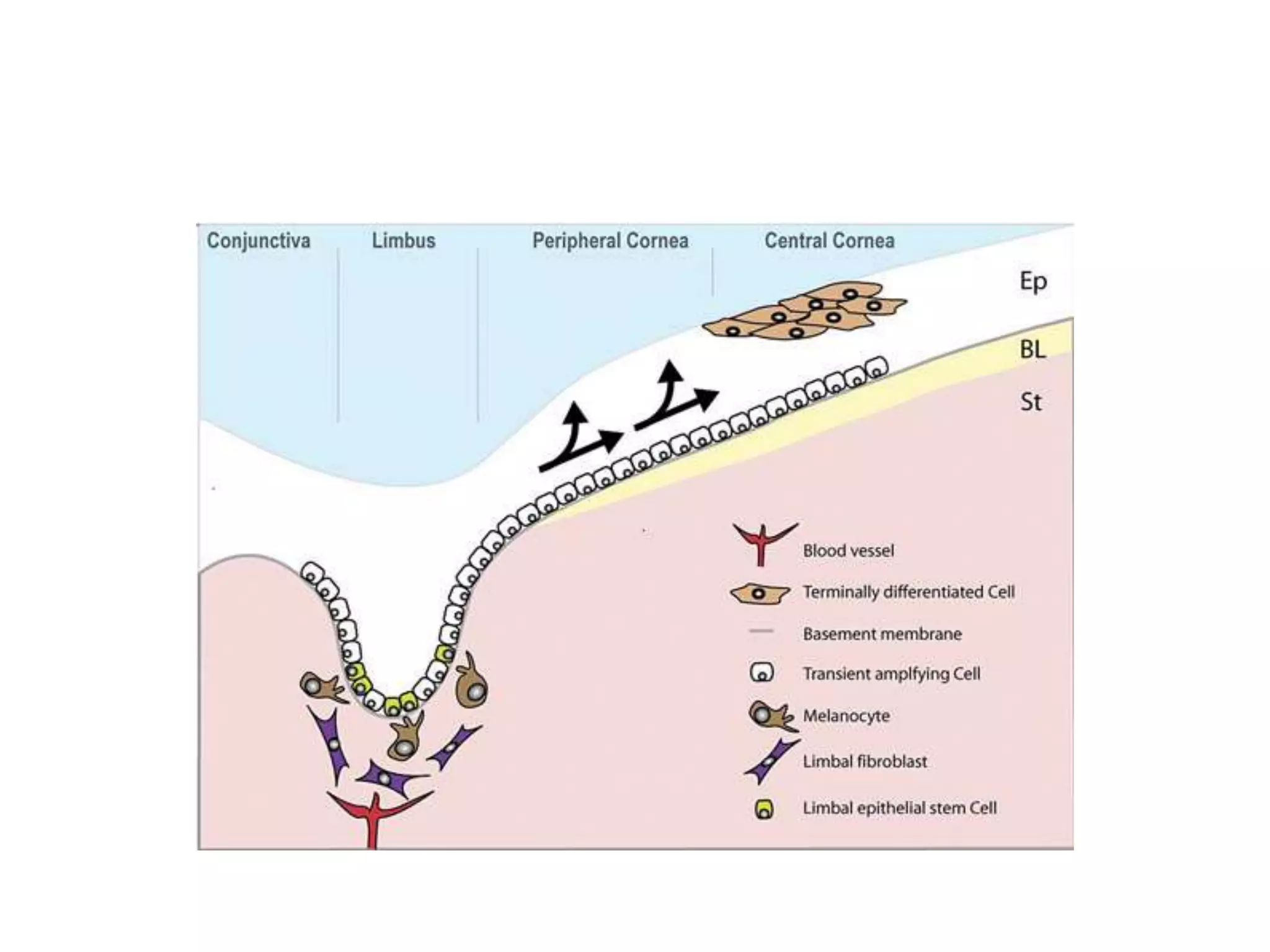 Ocular surface squamous neoplasia(ossn) | PPTX