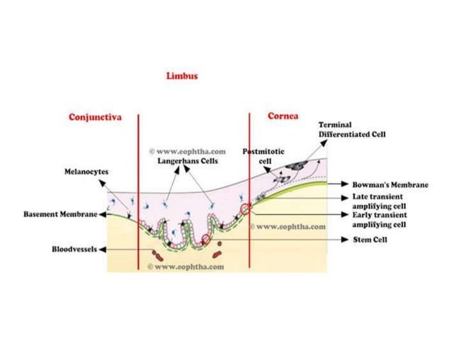 Ocular surface squamous neoplasia(ossn) | PPTX