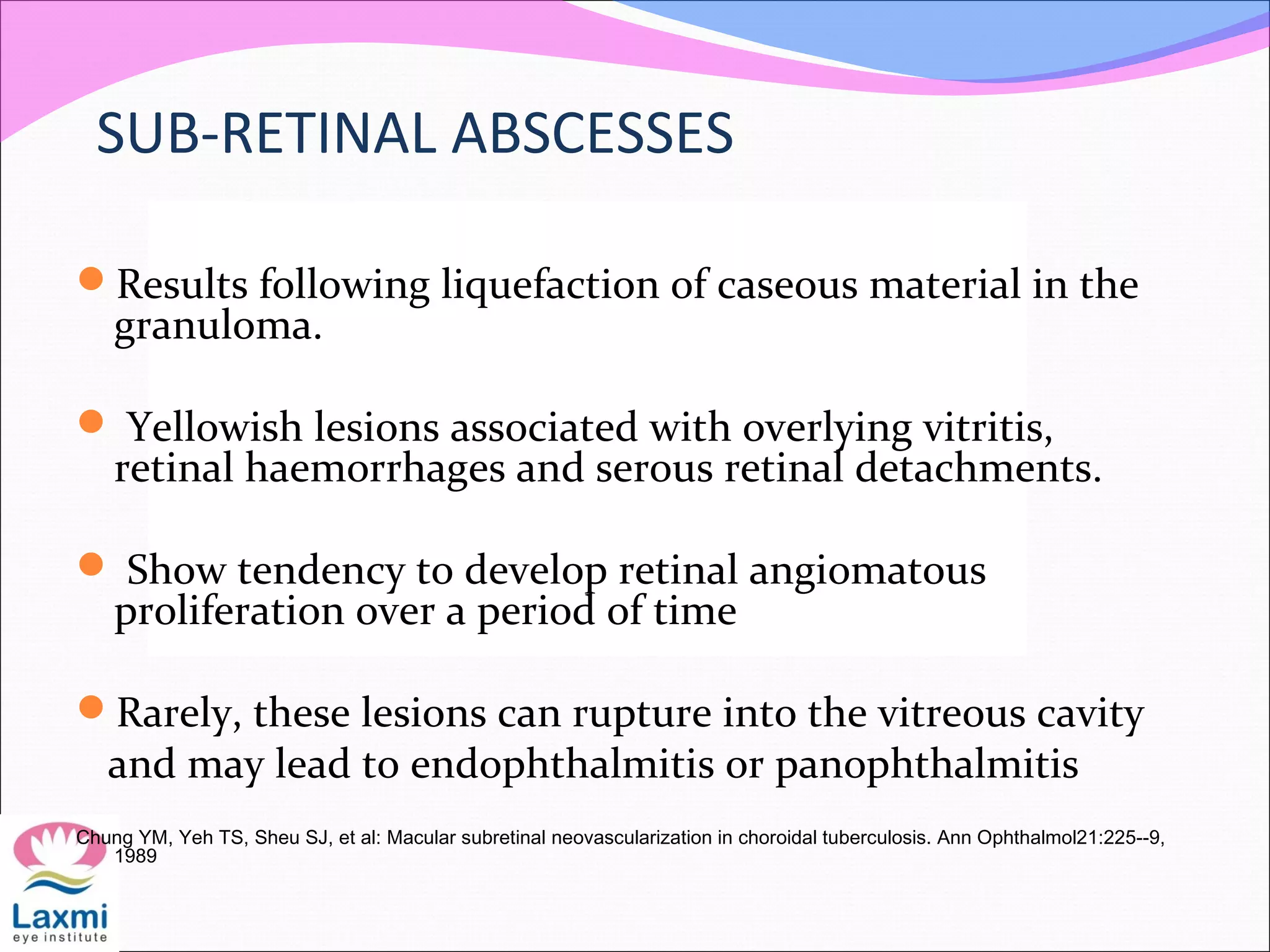 Ocular tb | PPT