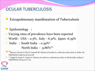 Ocular tb | PPT