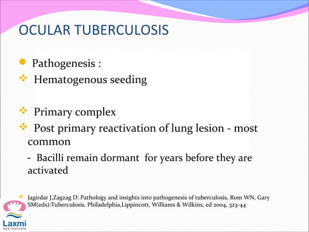 Ocular tb | PPT | Eye and Vision Conditions | Diseases and Conditions