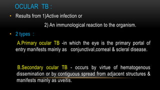 Ocular tb | PPTX