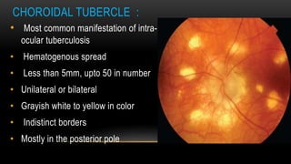 Choroidal Tubercles