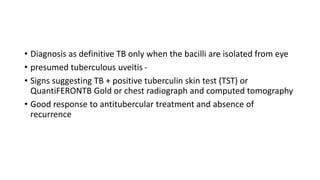 Ocular tb | PPTX