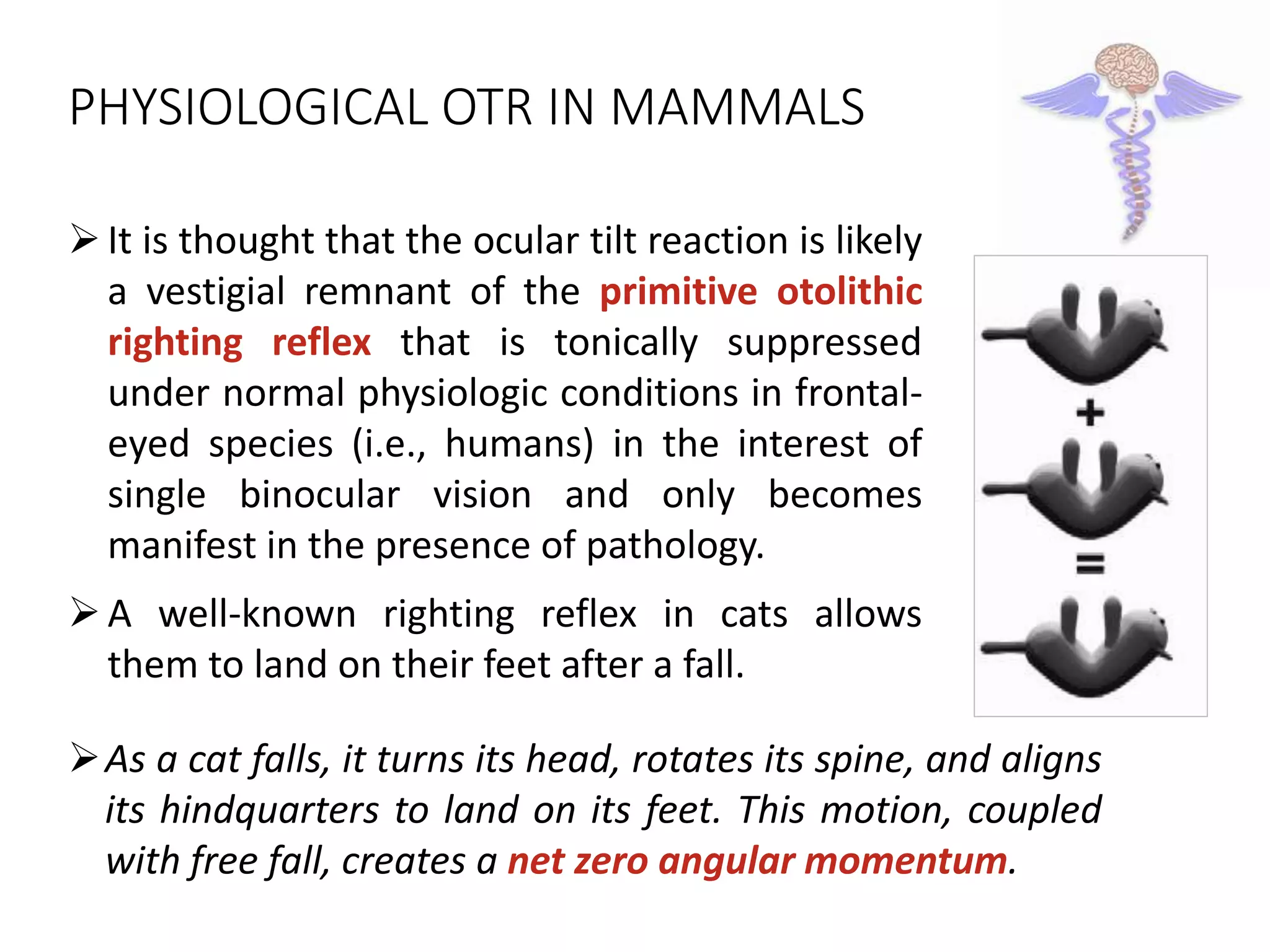 Ocular tilt reaction and skew deviation | PPTX